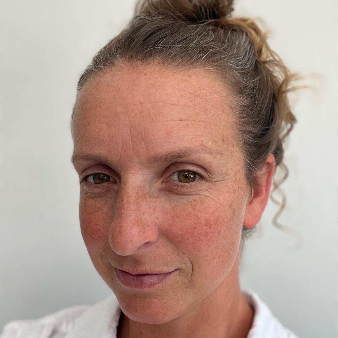 Stephanie Valent - ACEM ASM 2025